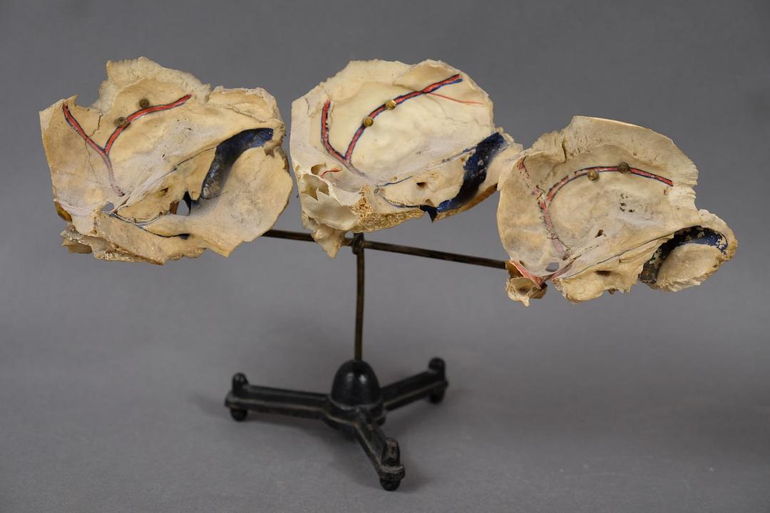 Vintage Pre 1940s Anatomical Display Temporal Bones Real Human Ears ...